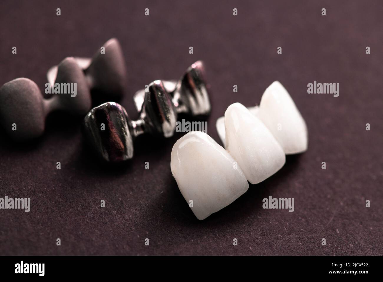 Teeth implant and crown installation process parts isolated on a black ...