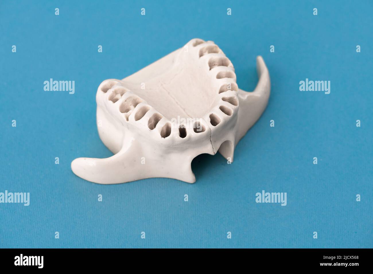 Upper human jaw without teeth model medical implant isolated on blue ...
