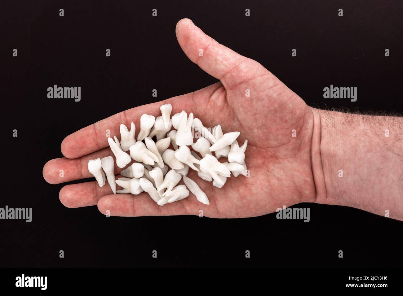 Teeth implant and crown installation process parts isolated on a blue ...