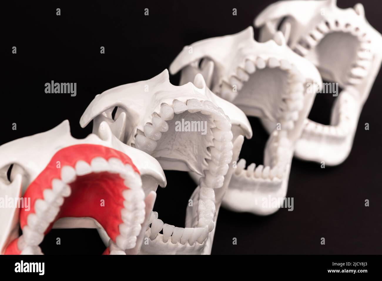 Teeth implant and crown installation process parts isolated on a blue ...