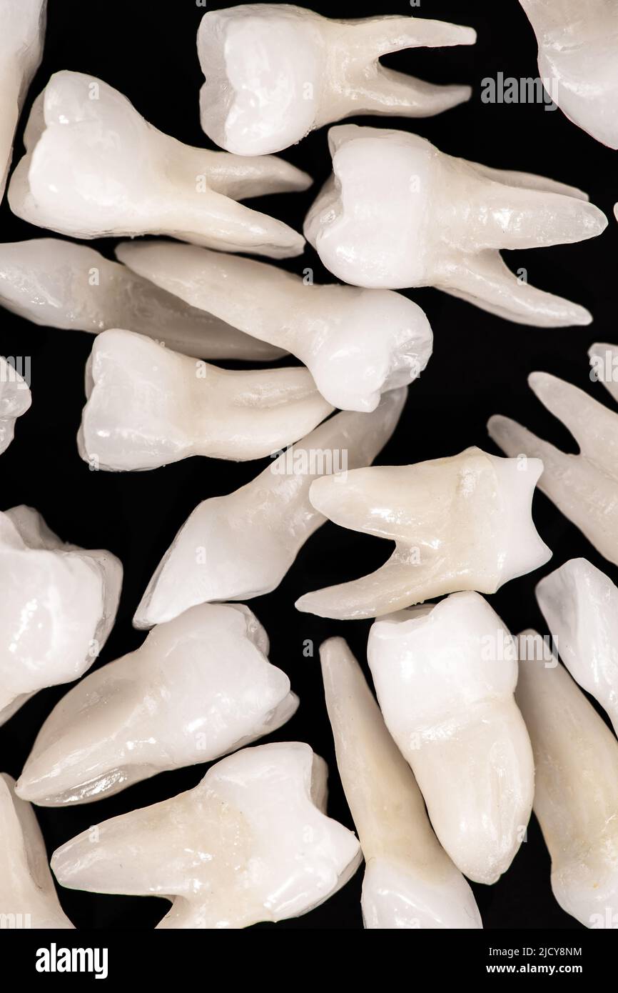 Teeth implant and crown installation process parts isolated on a blue ...