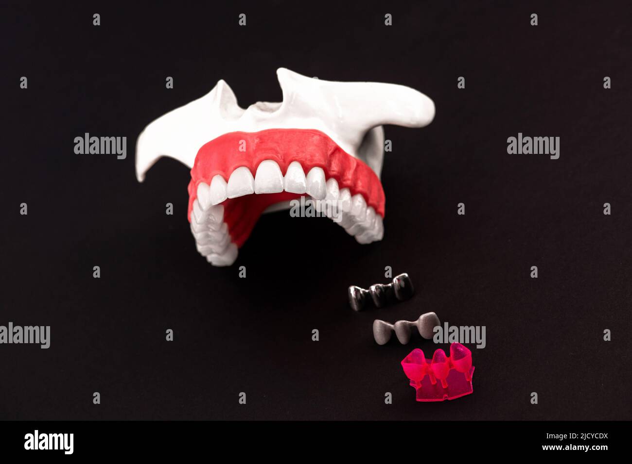 Teeth implant and crown installation process parts isolated on a blue ...