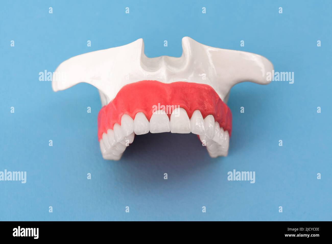 Teeth implant and crown installation process parts isolated on a blue ...