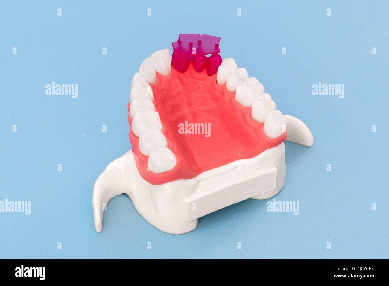 Teeth implant and crown installation process parts isolated on a blue ...
