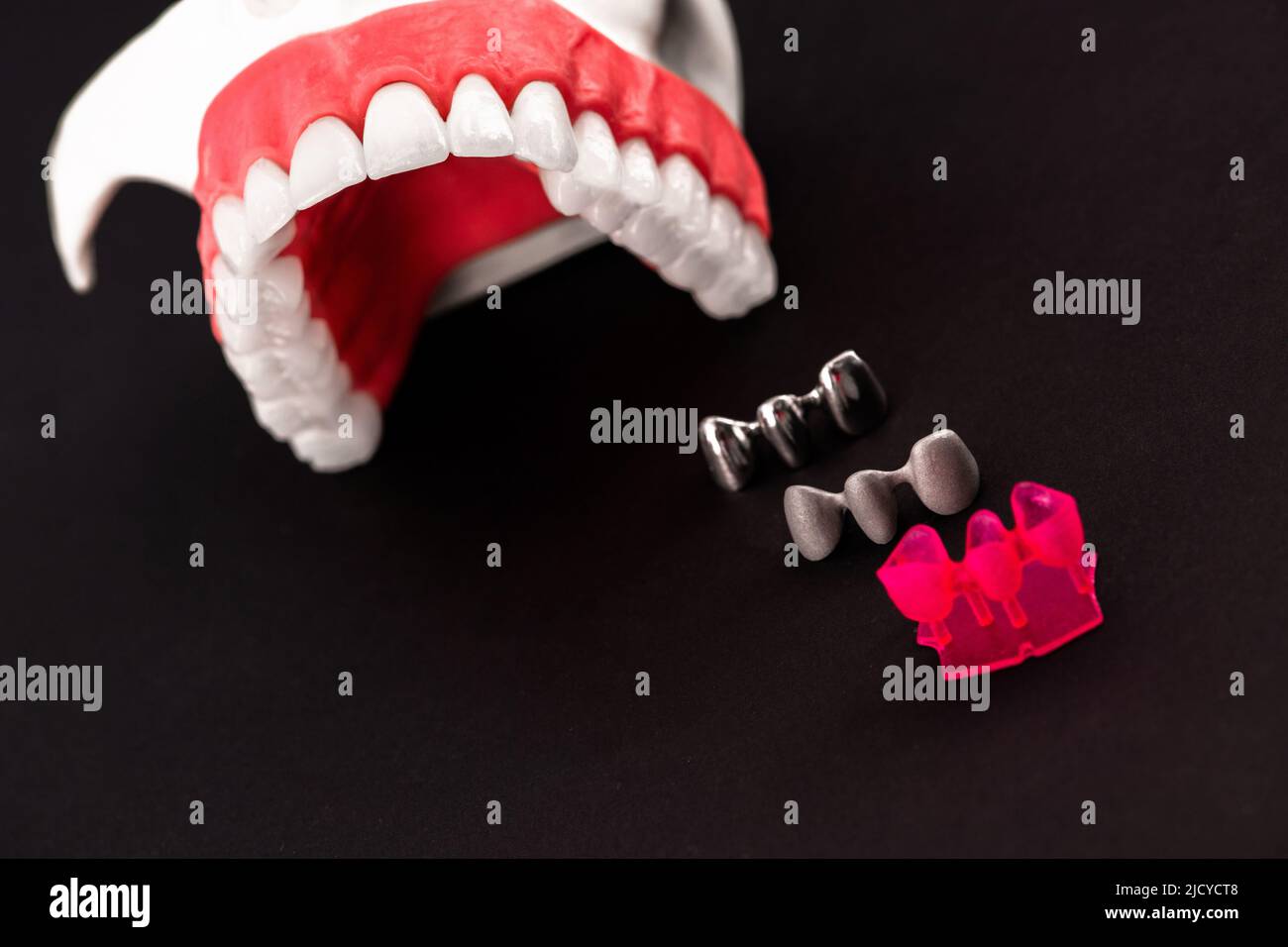 Teeth implant and crown installation process parts isolated on a blue ...