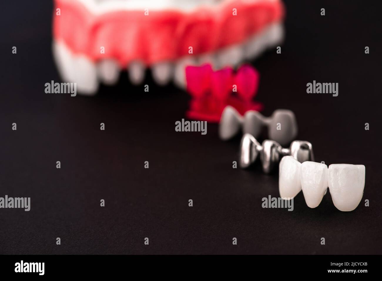 Teeth implant and crown installation process parts isolated on a blue ...