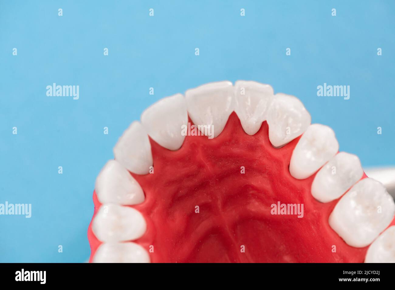 Teeth implant and crown installation process parts isolated on a blue ...