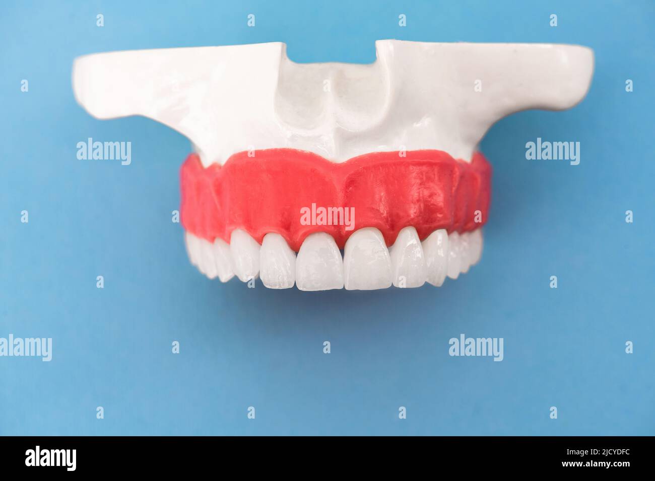 Teeth implant and crown installation process parts isolated on a blue ...