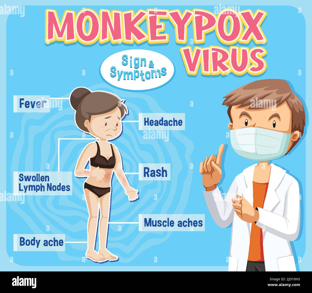 Monkeypox virus sign and symptoms infographic illustration Stock Vector ...