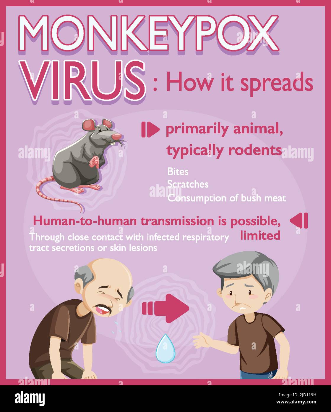 Monkeypox virus symptoms infographic illustration Stock Vector Image ...