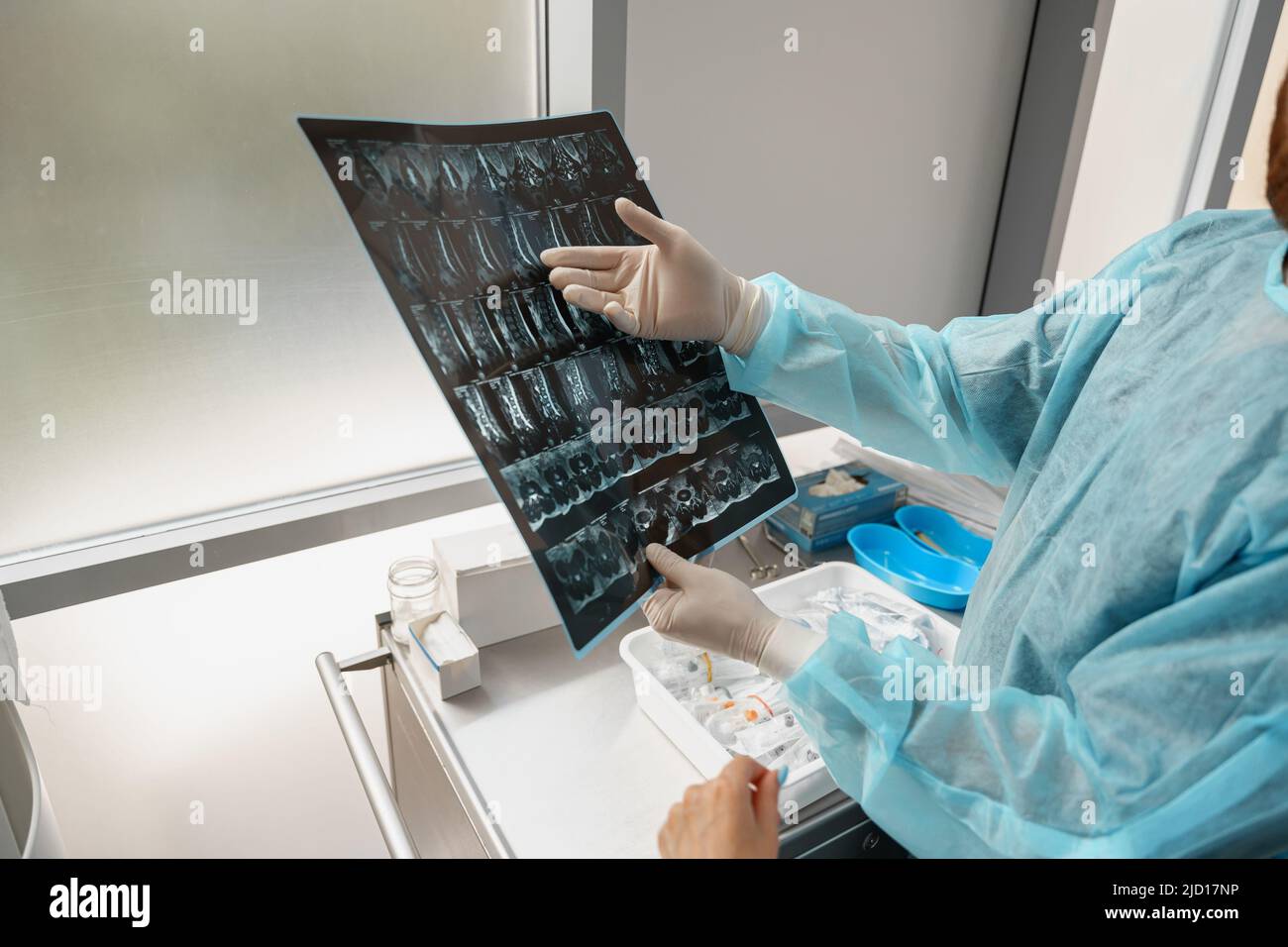 Close up of doctor's hands in uniform look on X-ray or MRI scan of the ...