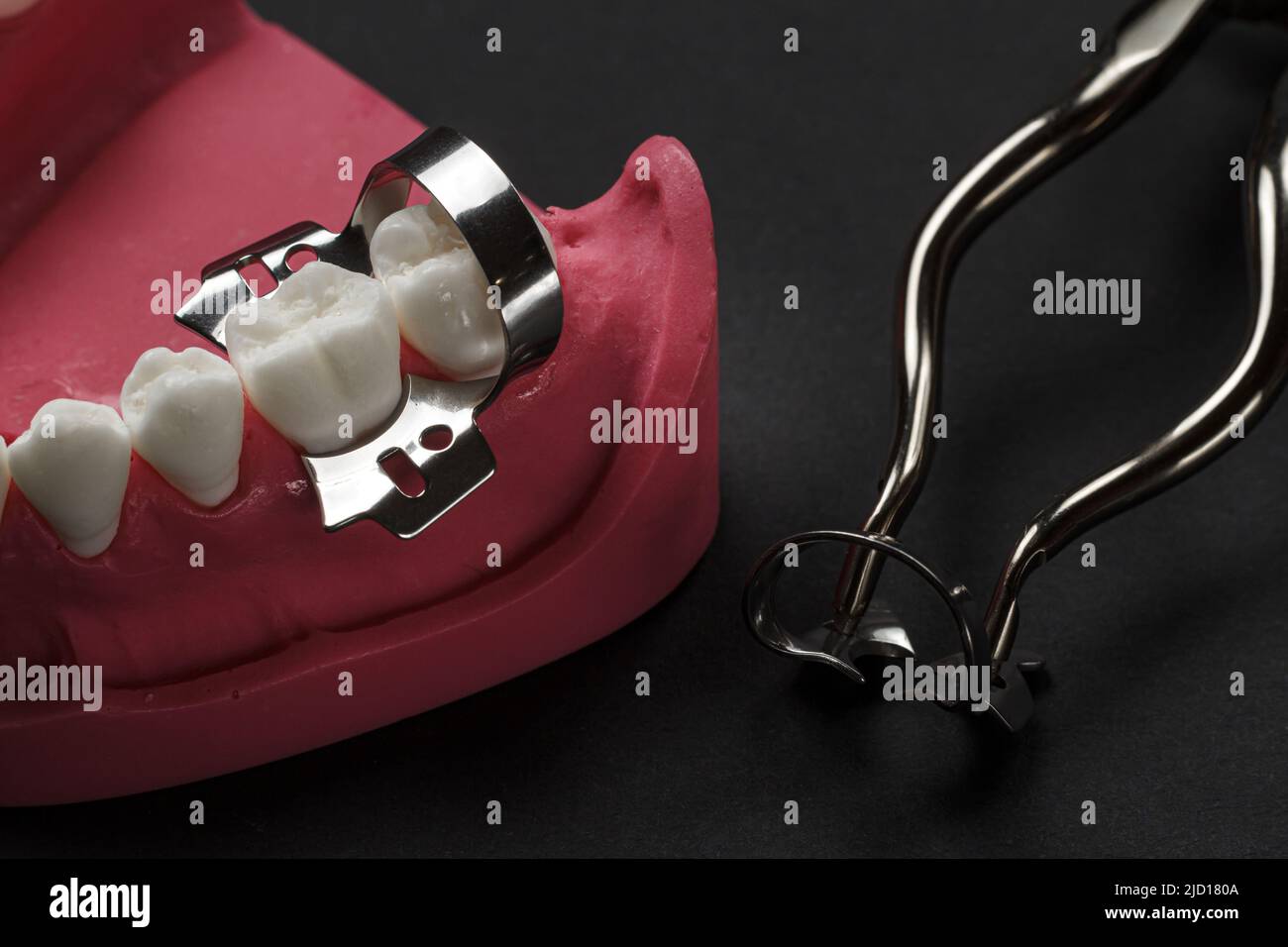Layout of the human jaw with a dental dam clamp and a rubber dam clamp ...