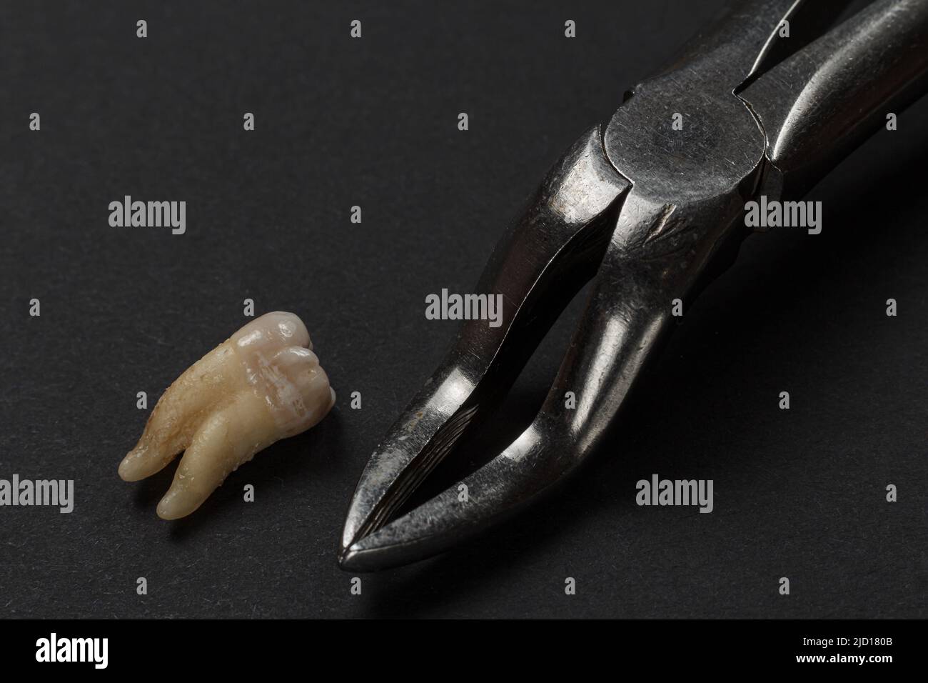 Stainless steel dental pliers and an extracted sick tooth on the black ...