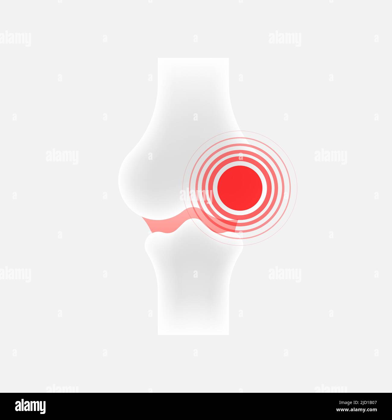 Infographic with joint pain. Human knee bone joint line icon Stock ...