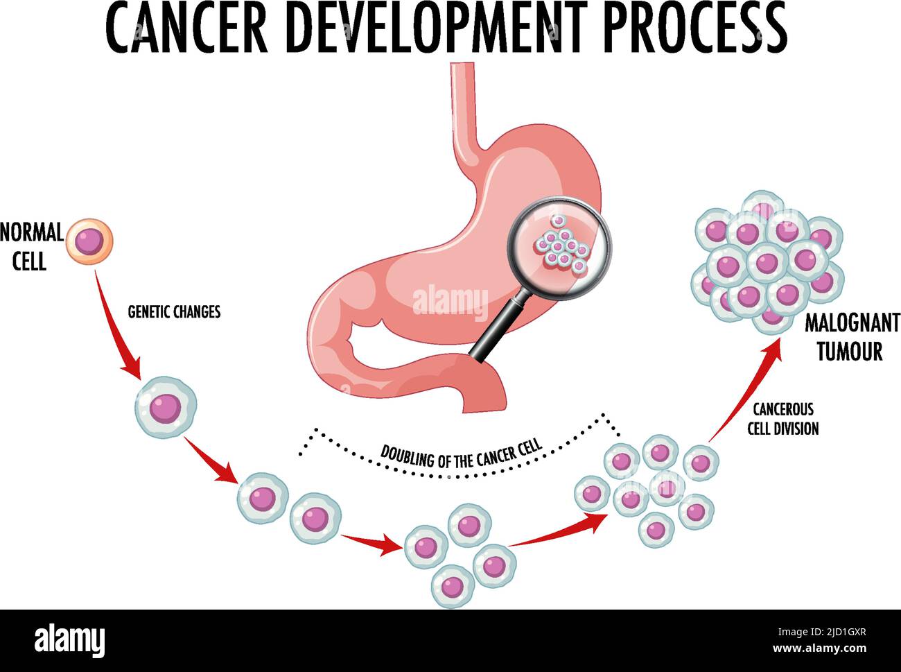 Diagram showing cancer development process illustration Stock Vector ...