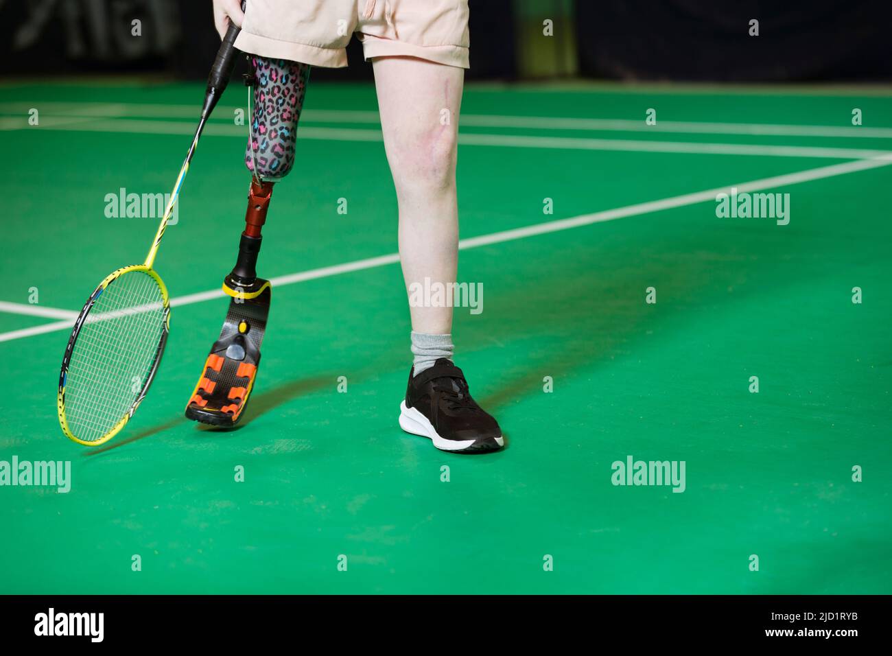 Girl with artificial leg playing badminton Stock Photo - Alamy