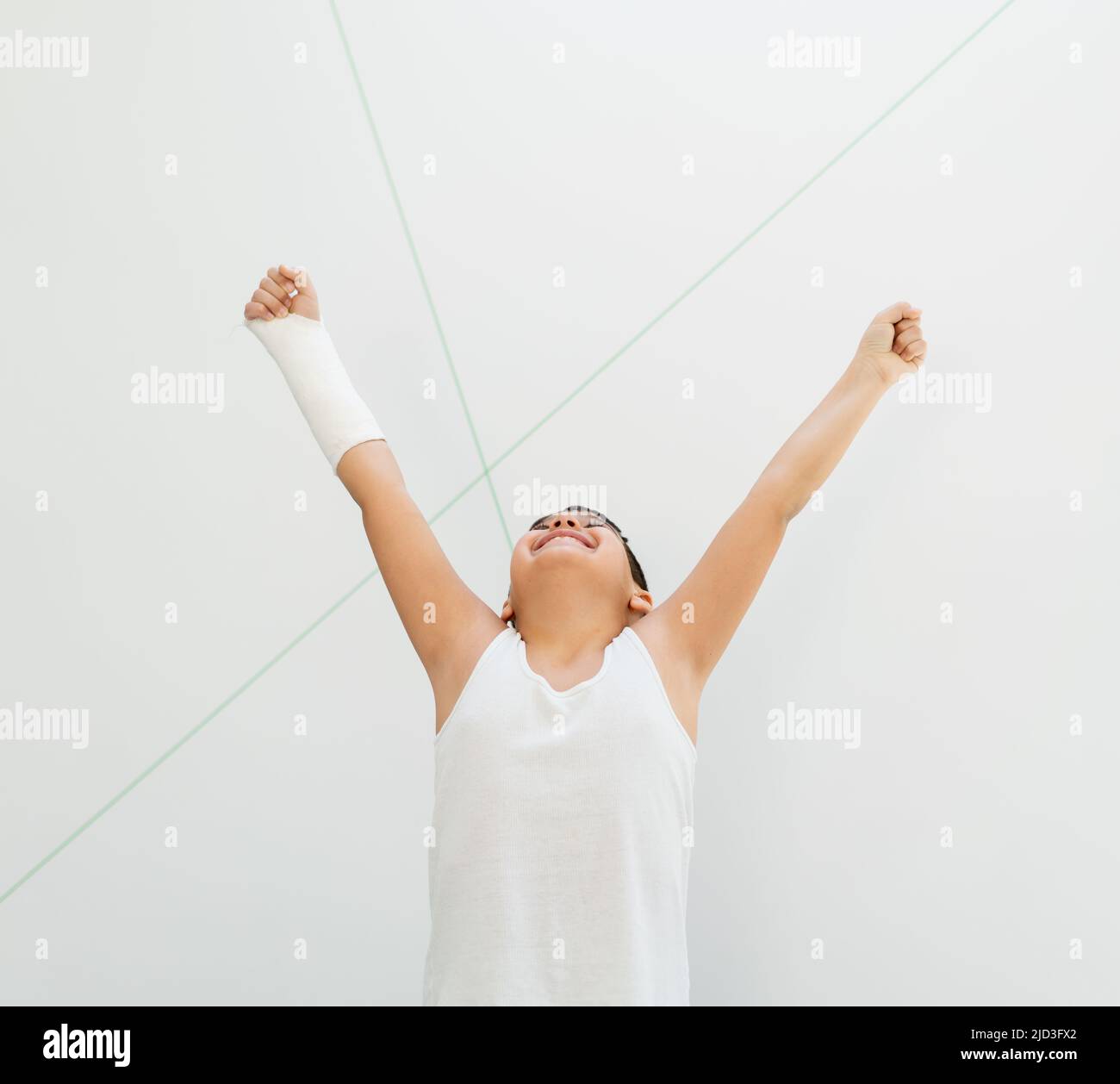 Boy keeps broken arm in gypsum, plaster arm, accident at home , injury ...