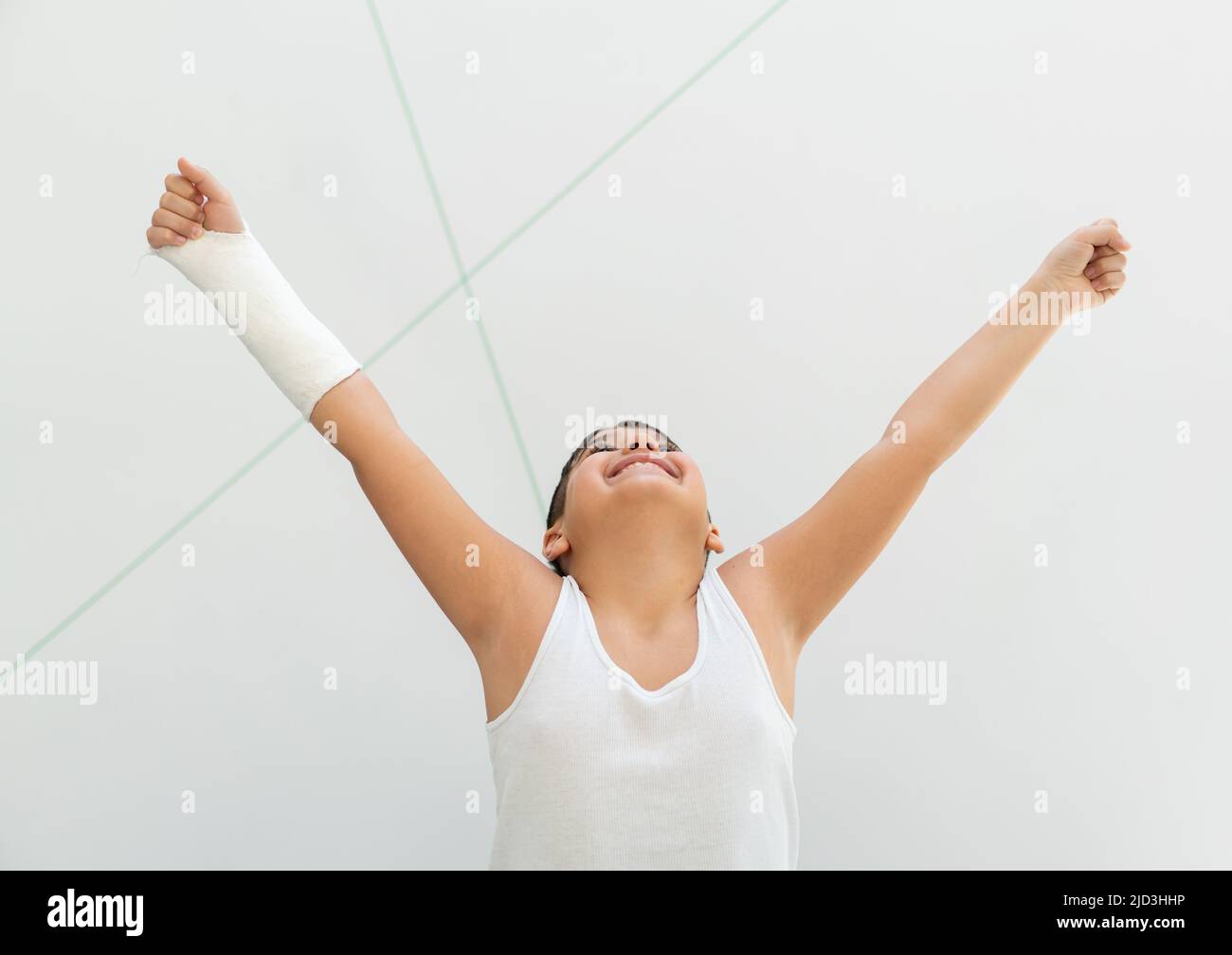 Boy keeps broken arm in gypsum, plaster arm, accident at home , injury ...