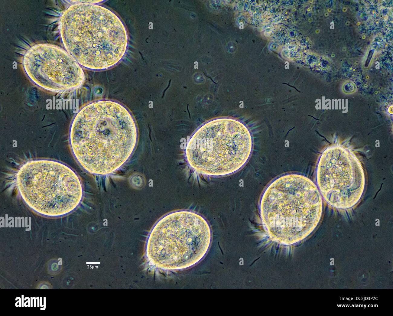 Euplotes sp. from a marine aquarium. The cells are about 12µM long ...