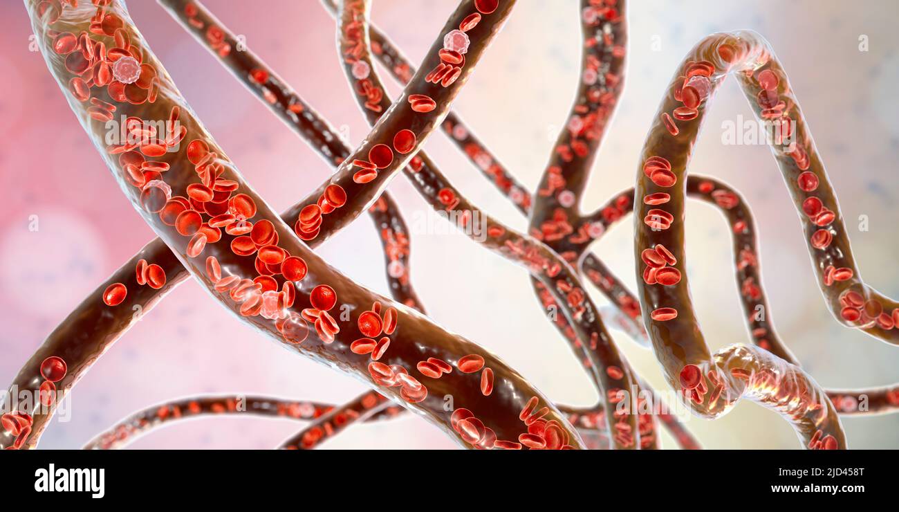 Blood vessels, illustration Stock Photo - Alamy