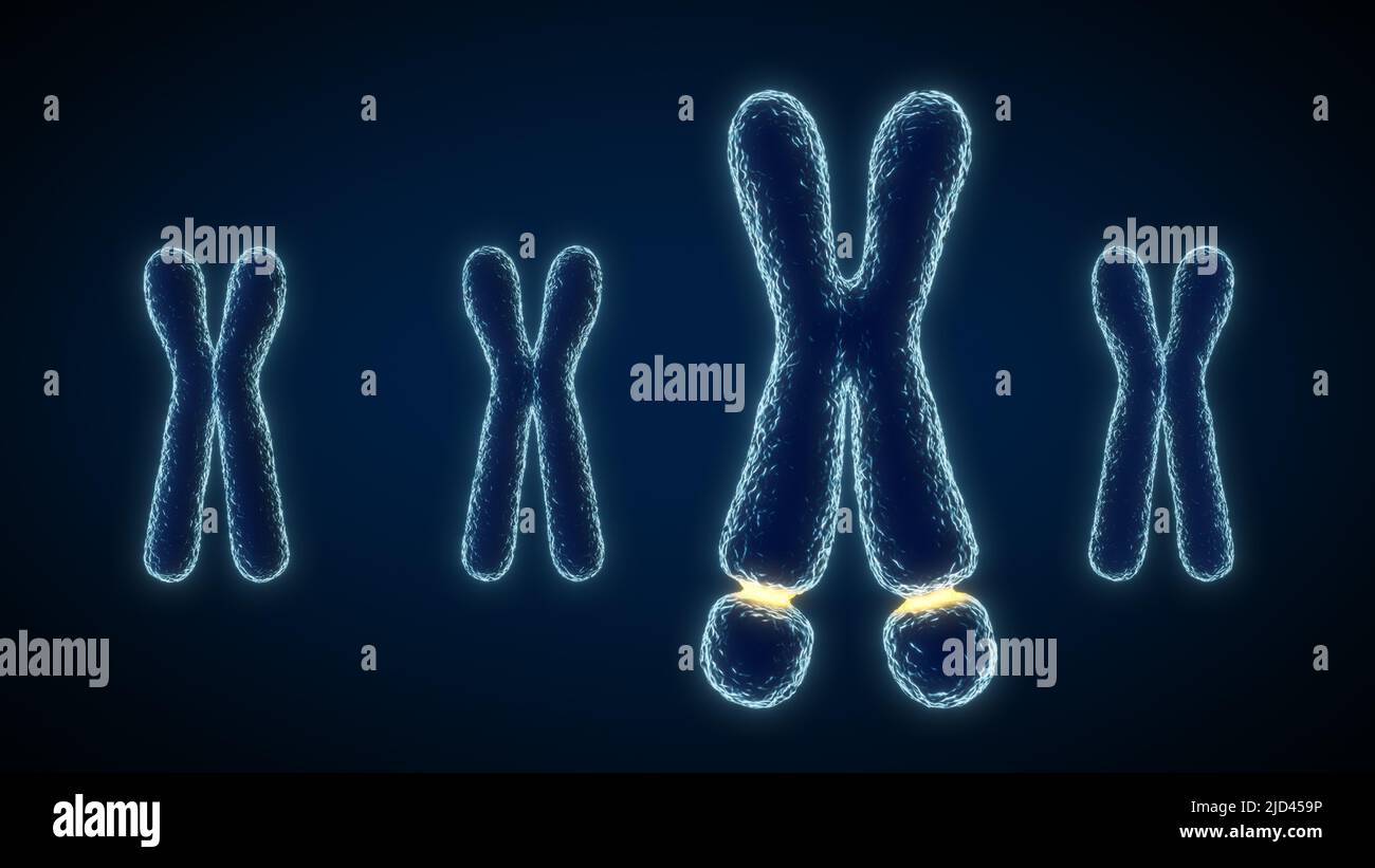 Fragile X chromosome, illustration Stock Photo - Alamy