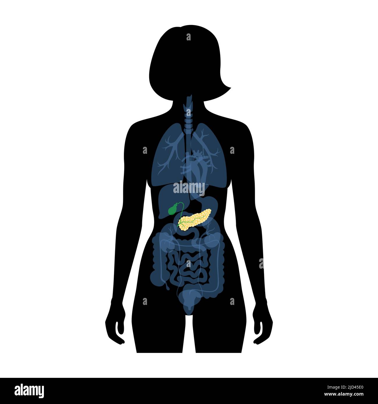 Gallstone pancreatitis hi-res stock photography and images - Alamy