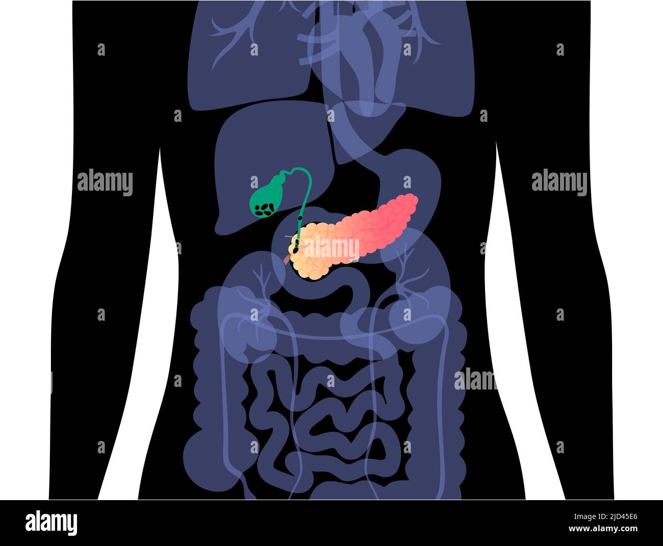 Pancreas stone hi-res stock photography and images - Alamy