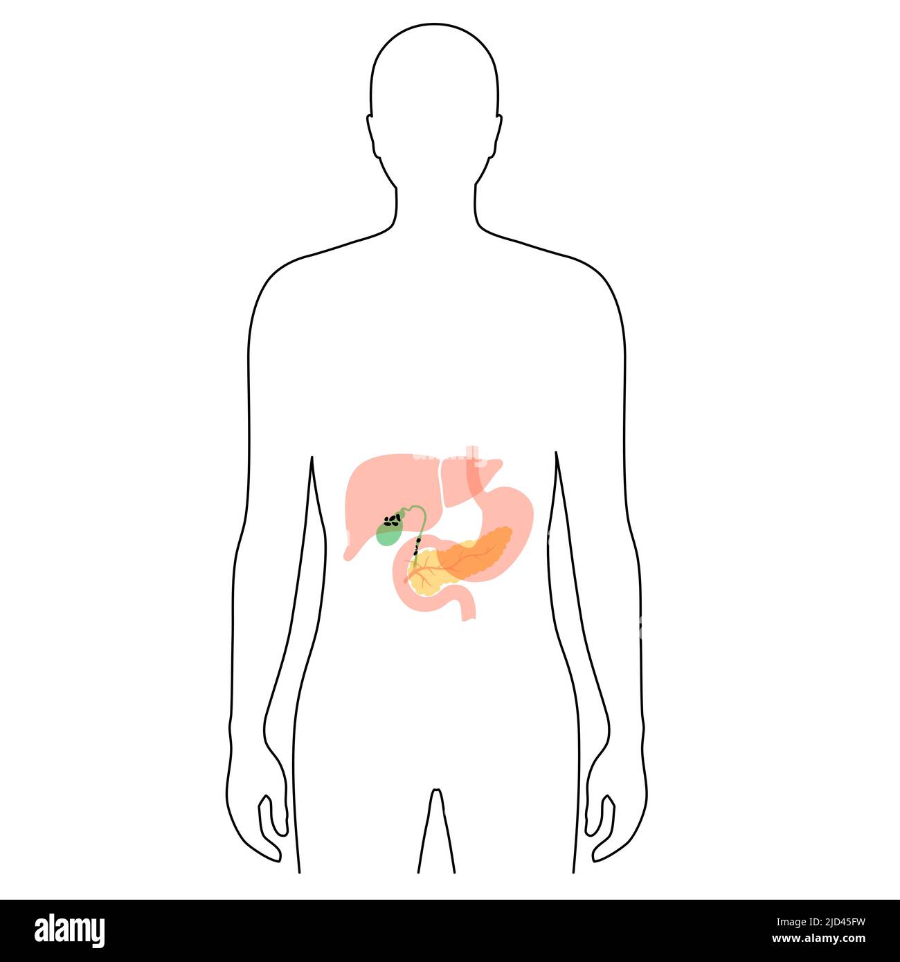Human gallbladder anatomy stone Cut Out Stock Images & Pictures - Alamy
