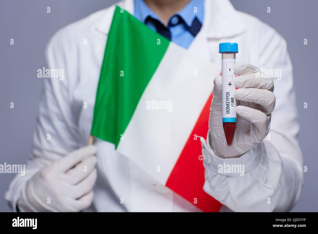 female medical doctor in white medical robe with monkeypox test tube ...