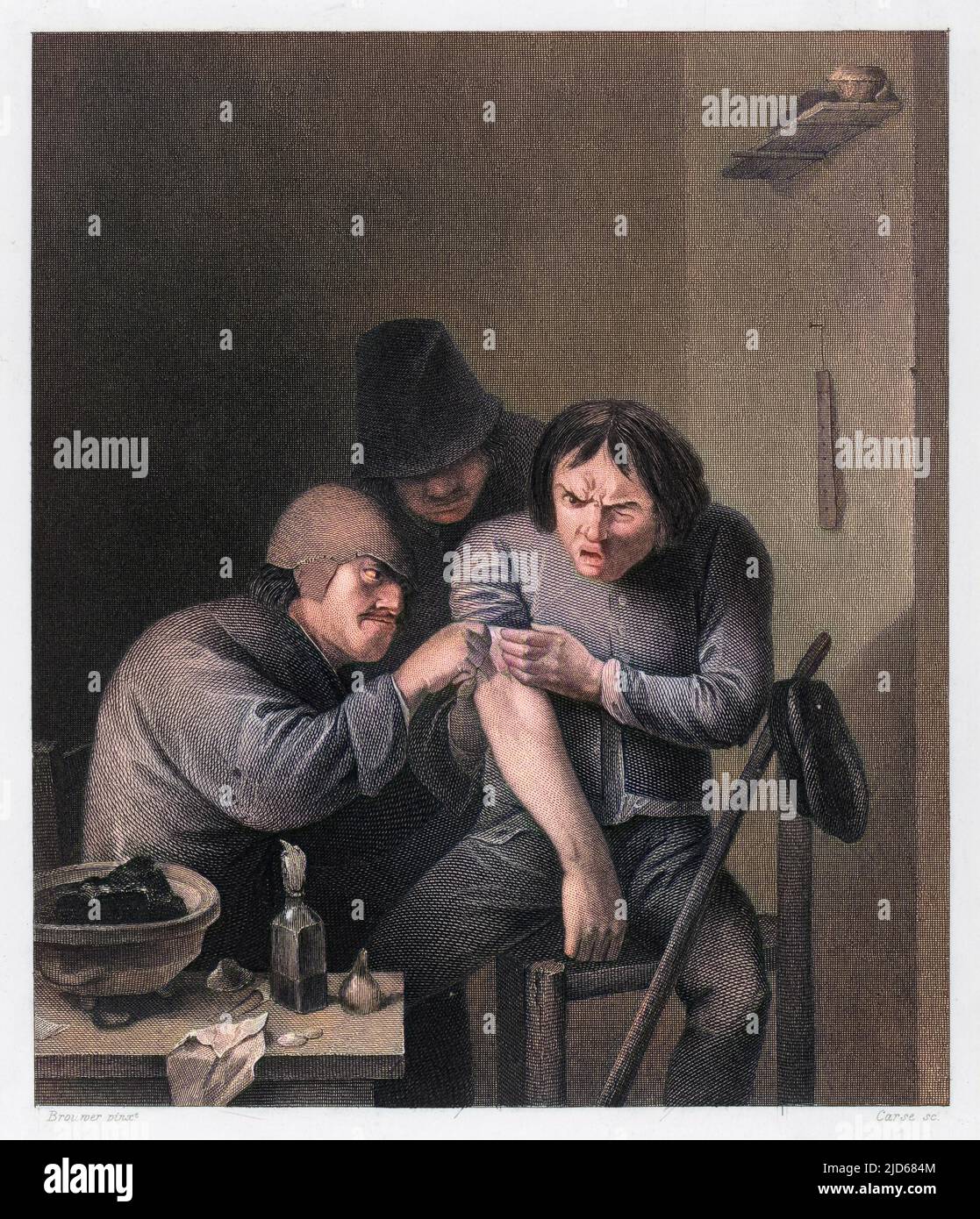 A barber-surgeon treating a patient Colourised version of : 10059705 ...