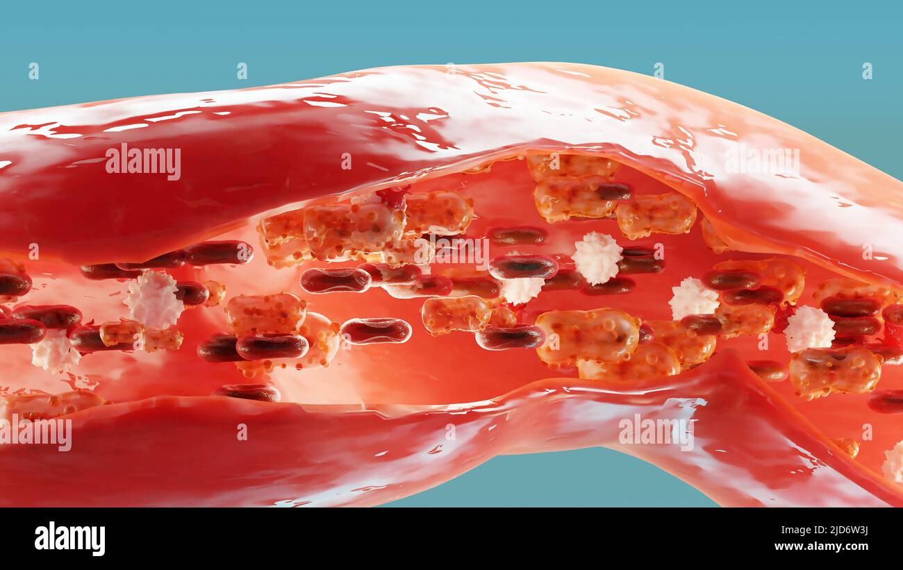 Monkeypox infection pandemic. monkeypox cell, symptoms or precautions ...