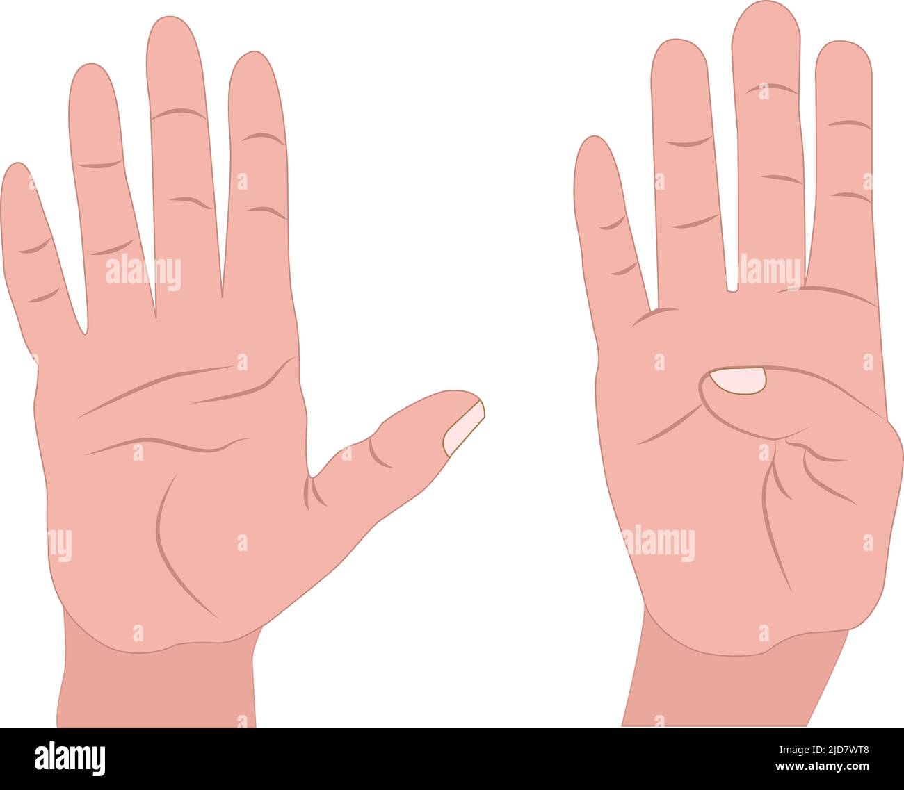 Thumb extension. Hand sequence from fist to open in hand drawings Stock ...