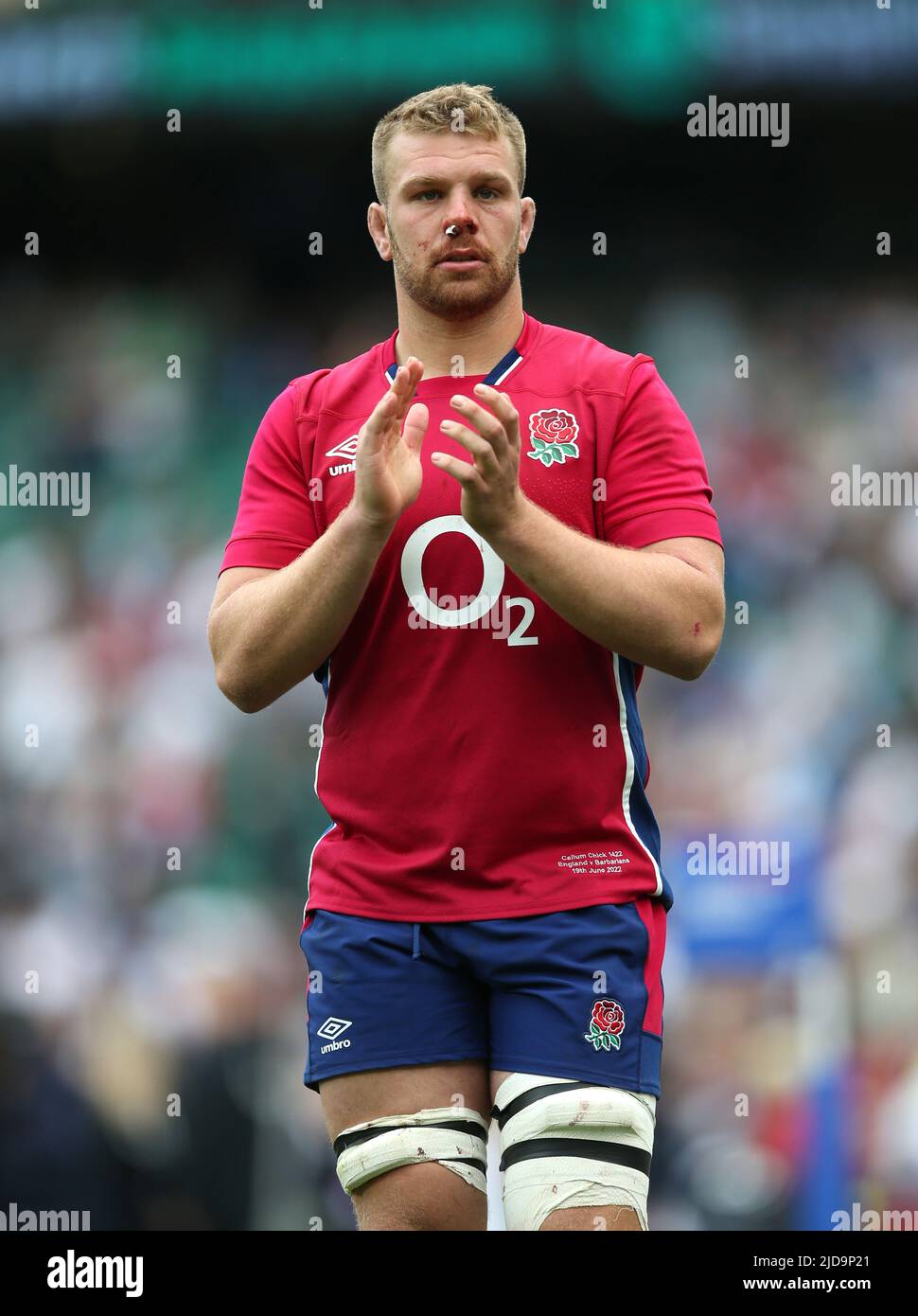 England's Callum Chick after the International Friendly match at ...