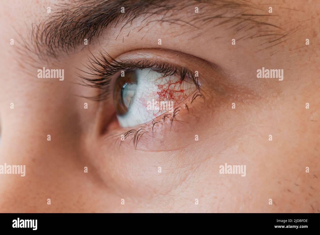 Ophthalmology. Human eye close-up with red vascular mesh and ...