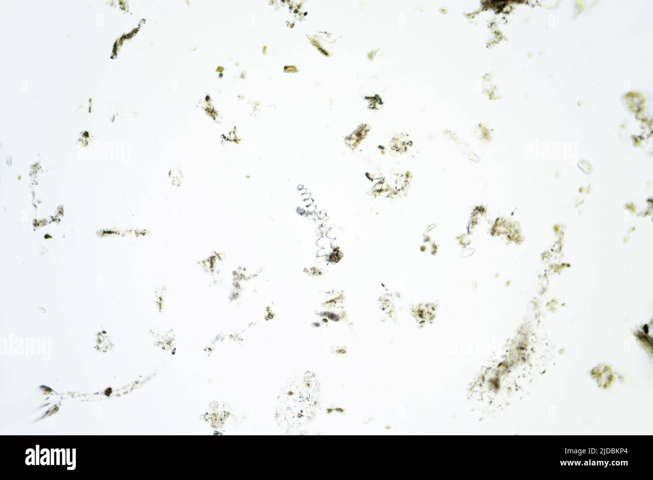 Spirochete, spiral bateria in the center of the photo. Sample taken ...