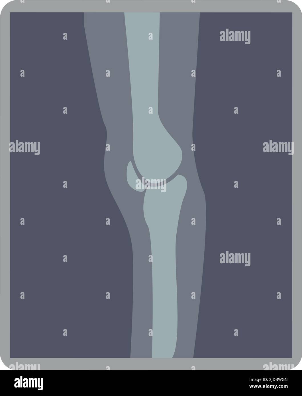 Knee x ray image semi flat color vector object Stock Vector Image & Art ...