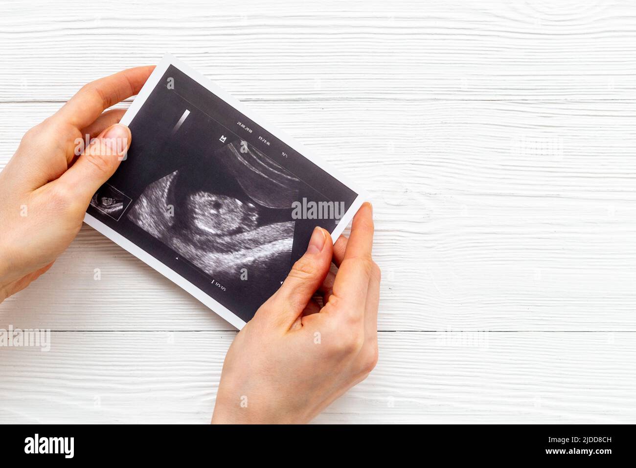 Womans hands holding ultrasound scan of unborn baby. Pregnancy ...