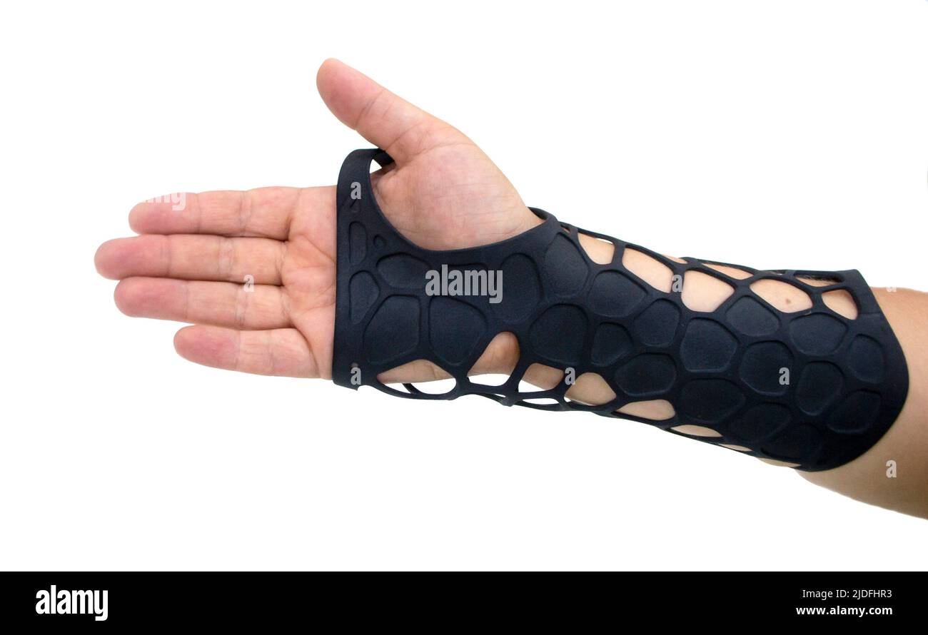 Orthopedic plastic prosthesis printed on powder 3D printer on hand ...