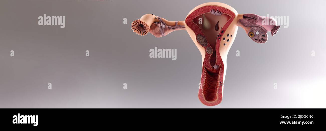 Model of the female reproductive system on gray background Stock Photo ...