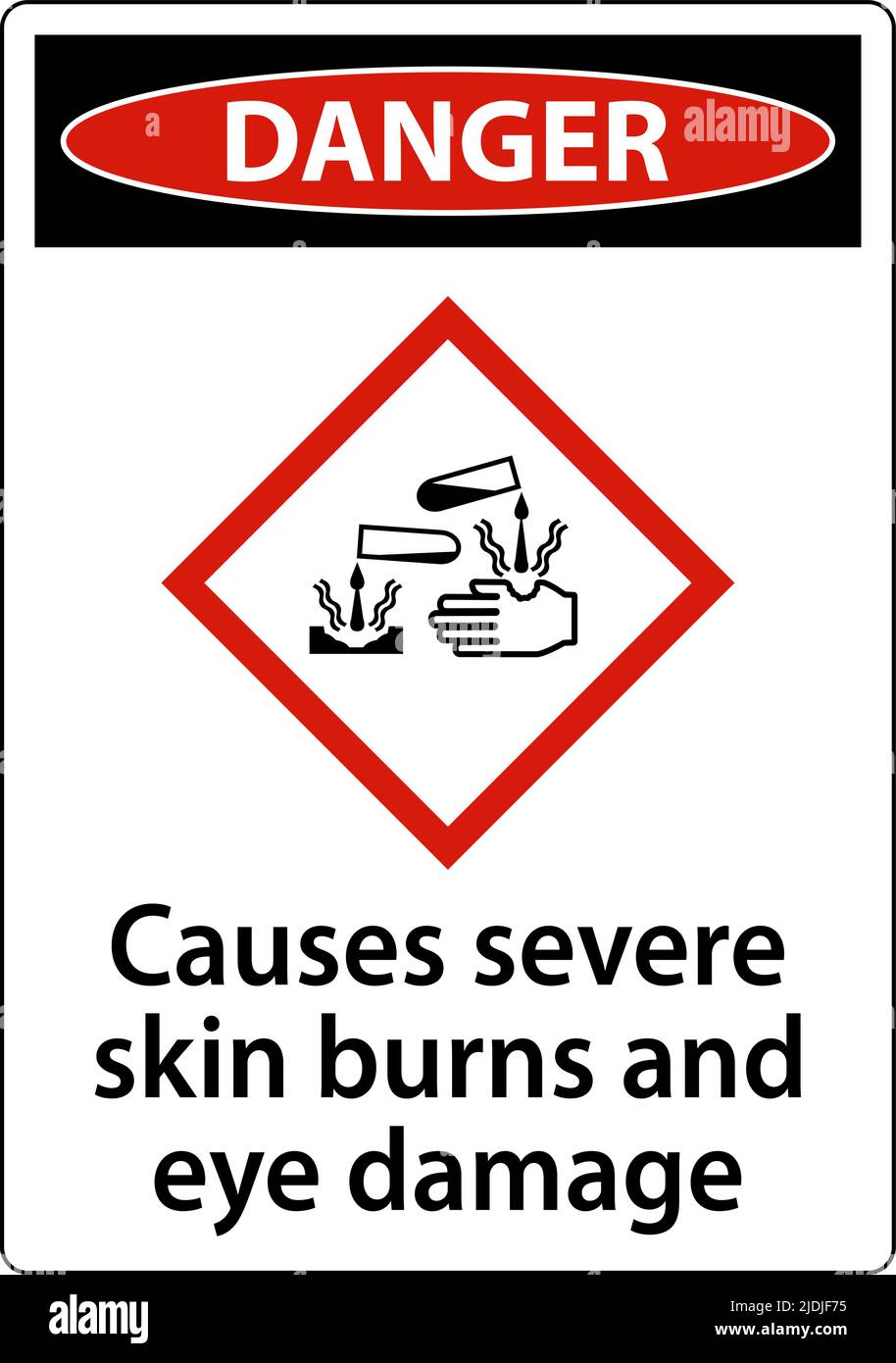 Severe skin damage Stock Vector Images - Alamy