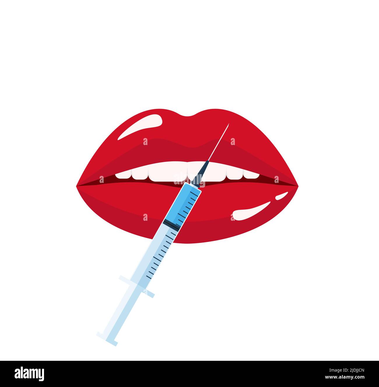 Modern vector illustration of lips injections. Lip augmentation ...