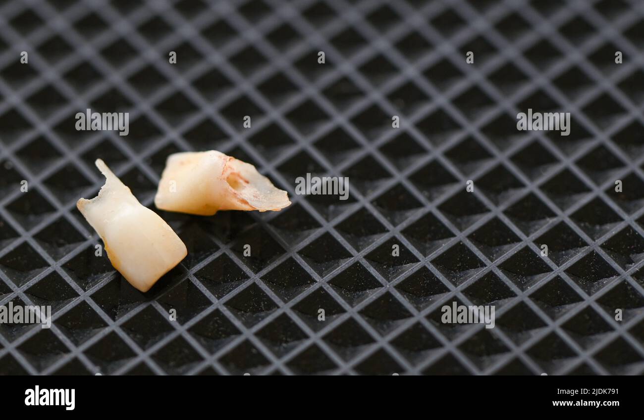 Milk tooth , Close up baby teeth of tooth loss on dark background ...