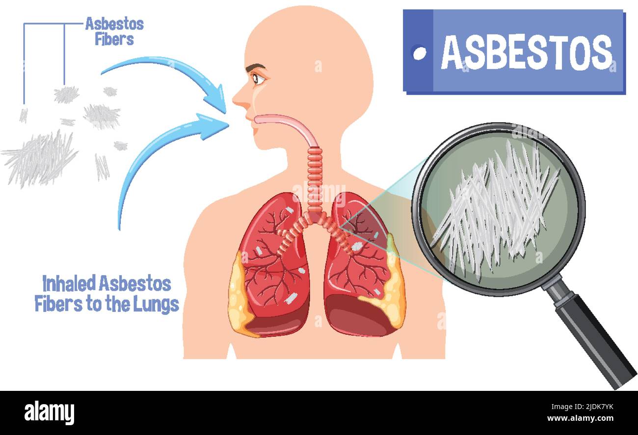Asbestos exposure Cut Out Stock Images & Pictures - Alamy