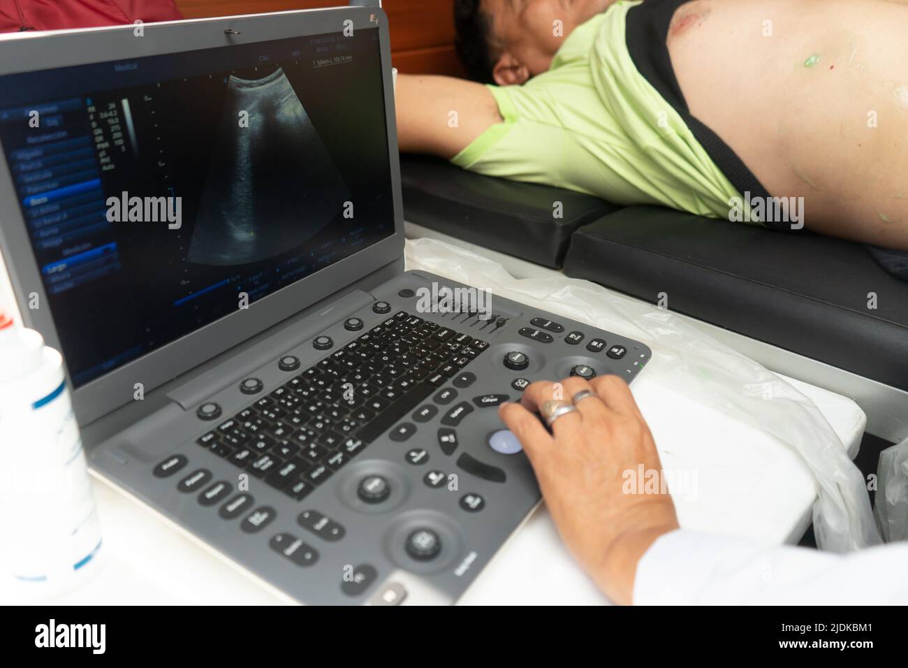 Monitoring on a portable ultrasound equipment screen Stock Photo - Alamy
