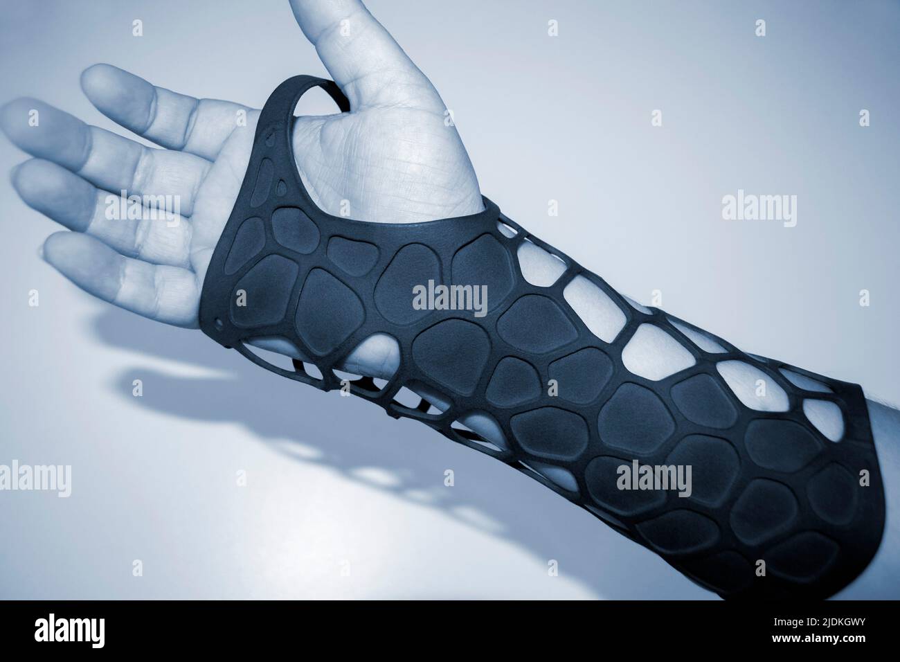 Orthopedic plastic prosthesis printed on powder 3D printer on hand ...