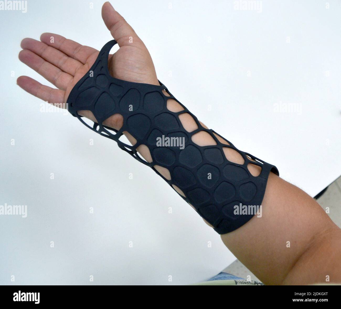 Orthopedic plastic prosthesis printed on powder 3D printer on hand ...