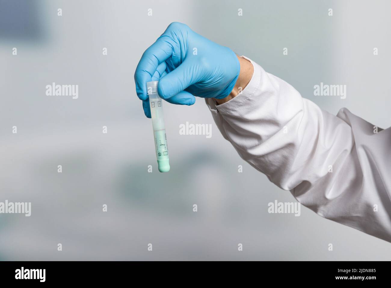 Doctor's hand with a test tube for stool sample for colon cancer ...