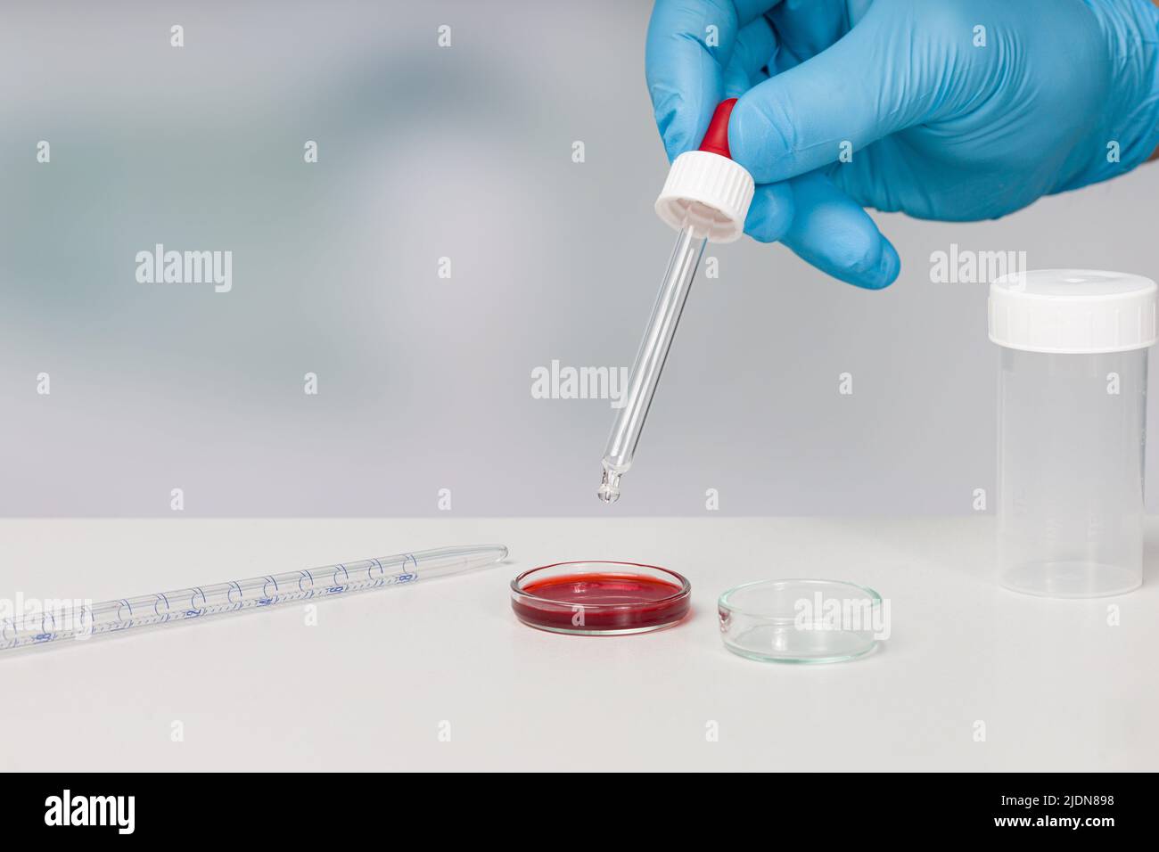 Close-up of medical laboratory working on probes with pipette and petri ...