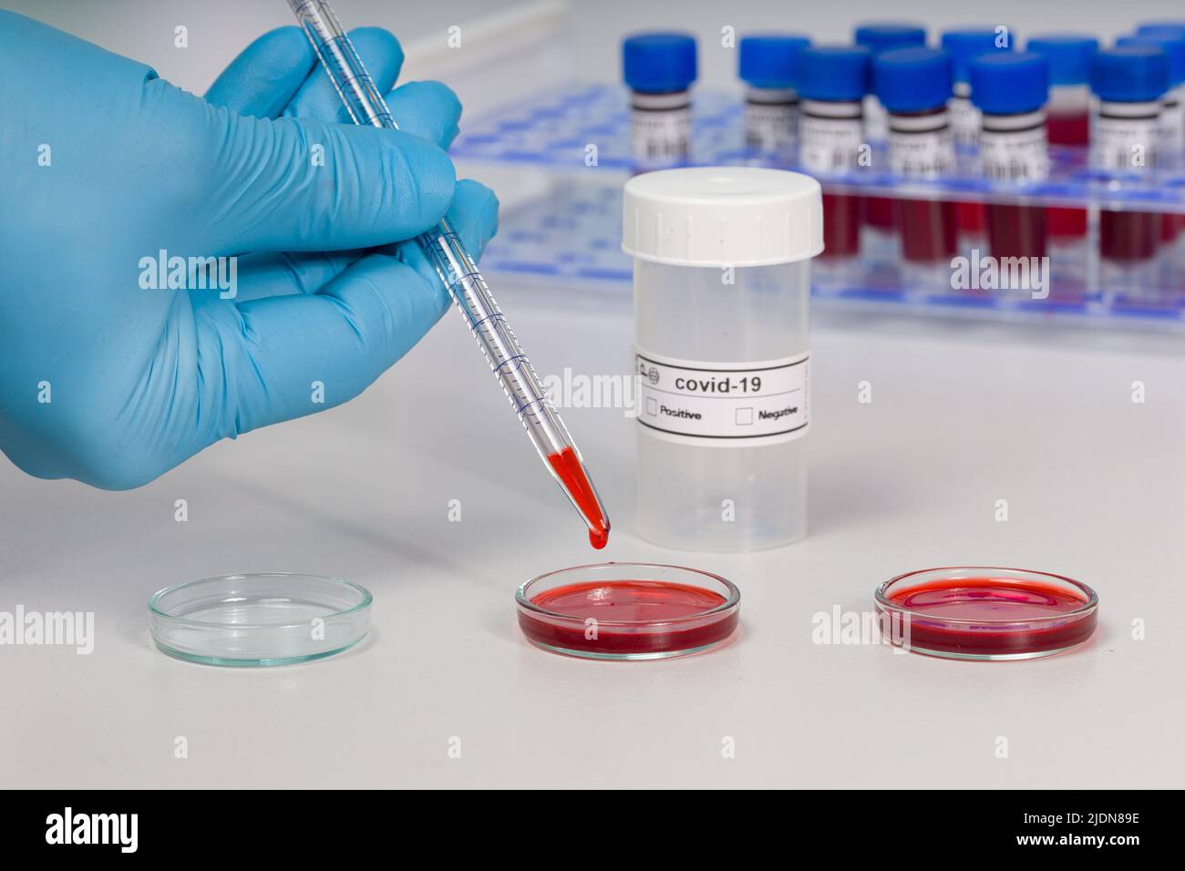 Close-up of medical laboratory working on probes with pipette and petri ...