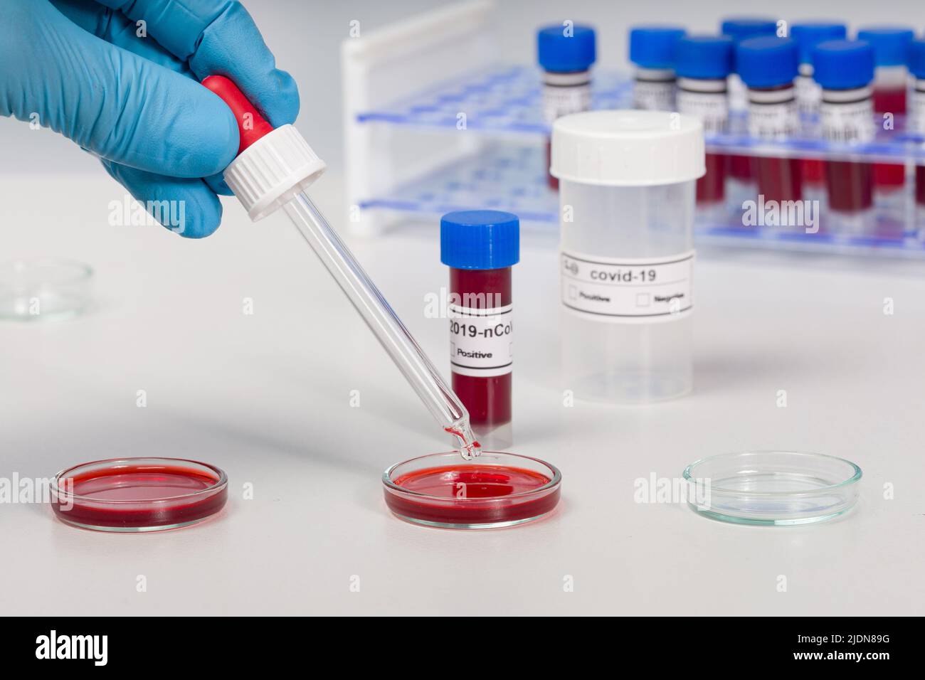 Close-up of medical laboratory working on probes with pipette and petri ...